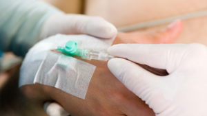 Vascular Access Devices - Savannah Vascular Institute